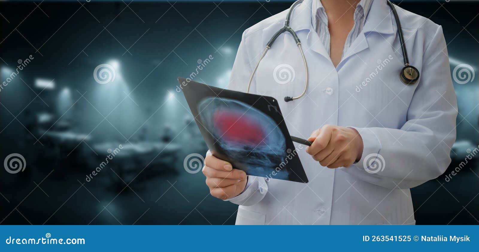 Concept of Diagnosing a Brain Disease Using X-rays Stock Image - Image ...