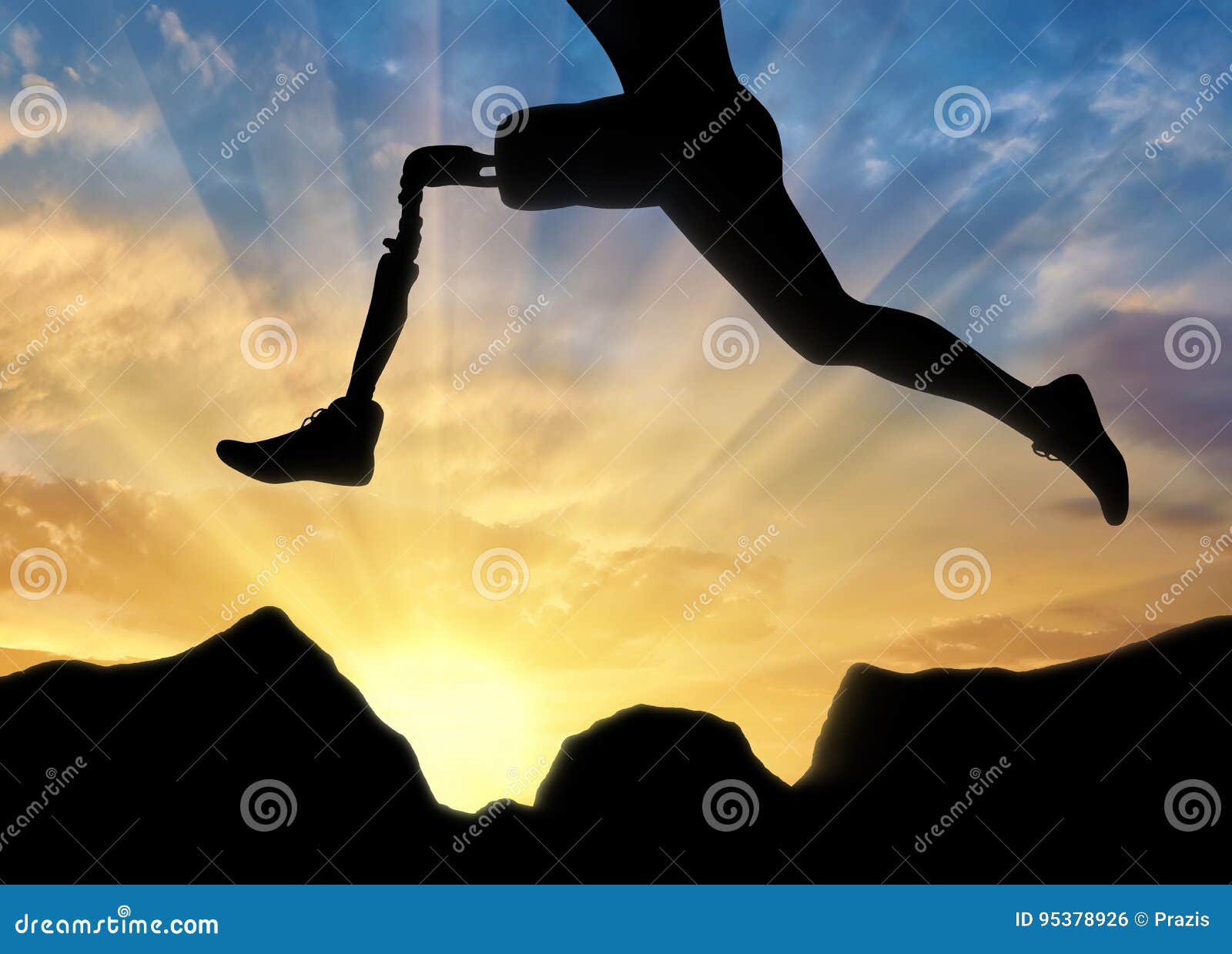 Concept of Disability, Prosthetic Leg Stock Photo - Image of rays ...