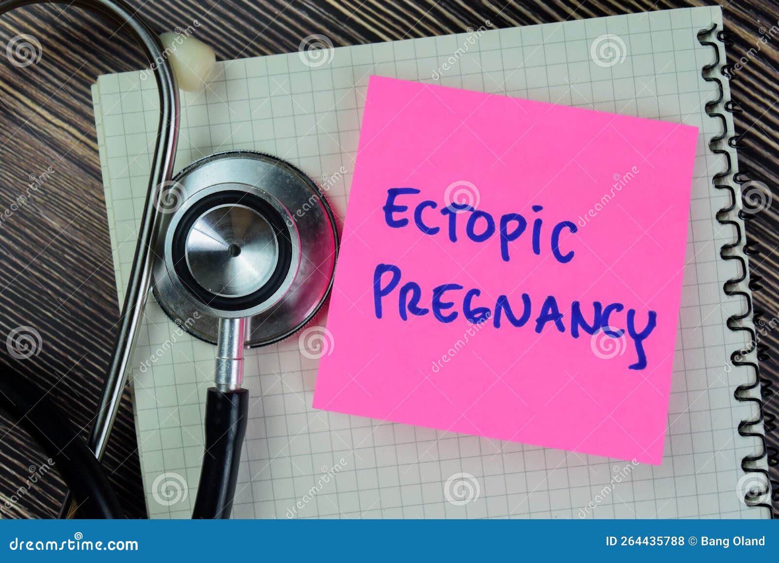 Concept of Ectopic Pregnancy Write on Sticky Notes with Stethoscope ...