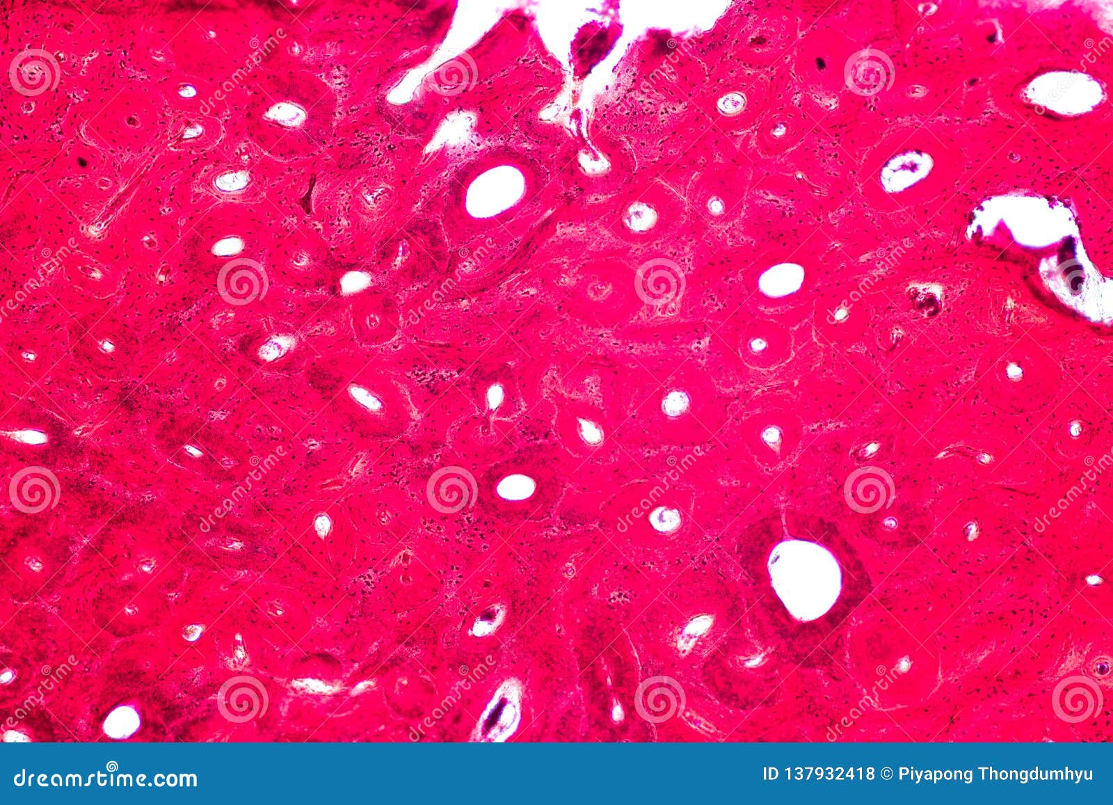 Concept of Education Anatomy and Physiology of Compact Bone, or ...