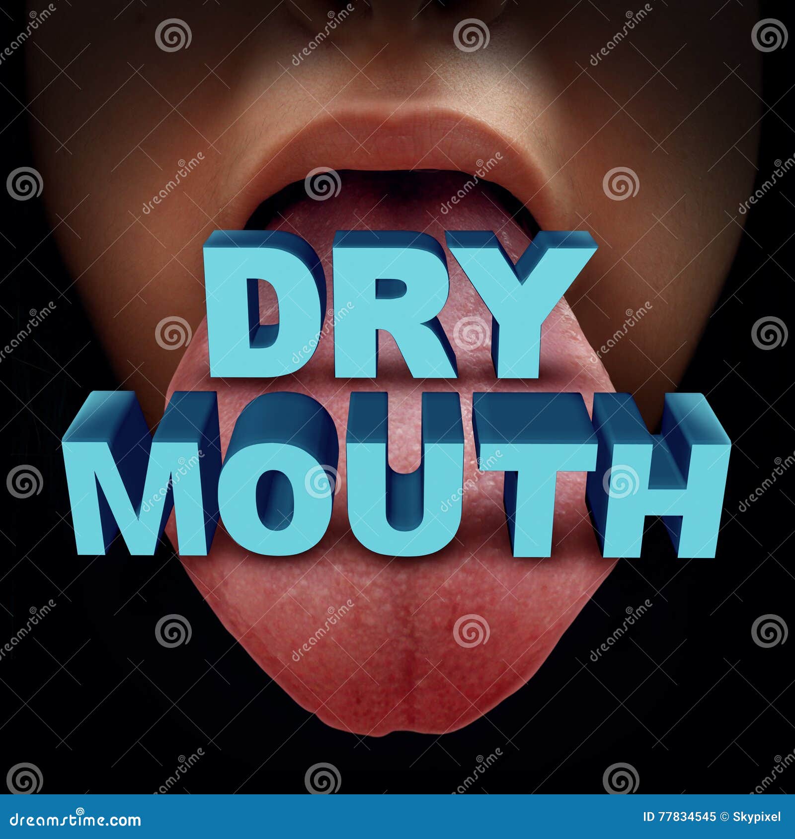 Concept Médical De Bouche Sèche Illustration Stock - Illustration du ...