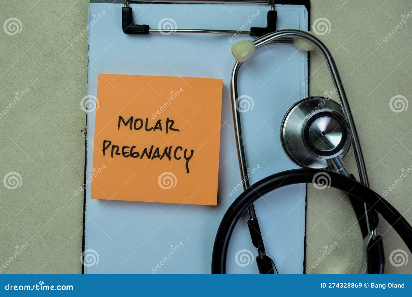 Concept of Molar Pregnancy Write on Sticky Notes with Stethoscope ...