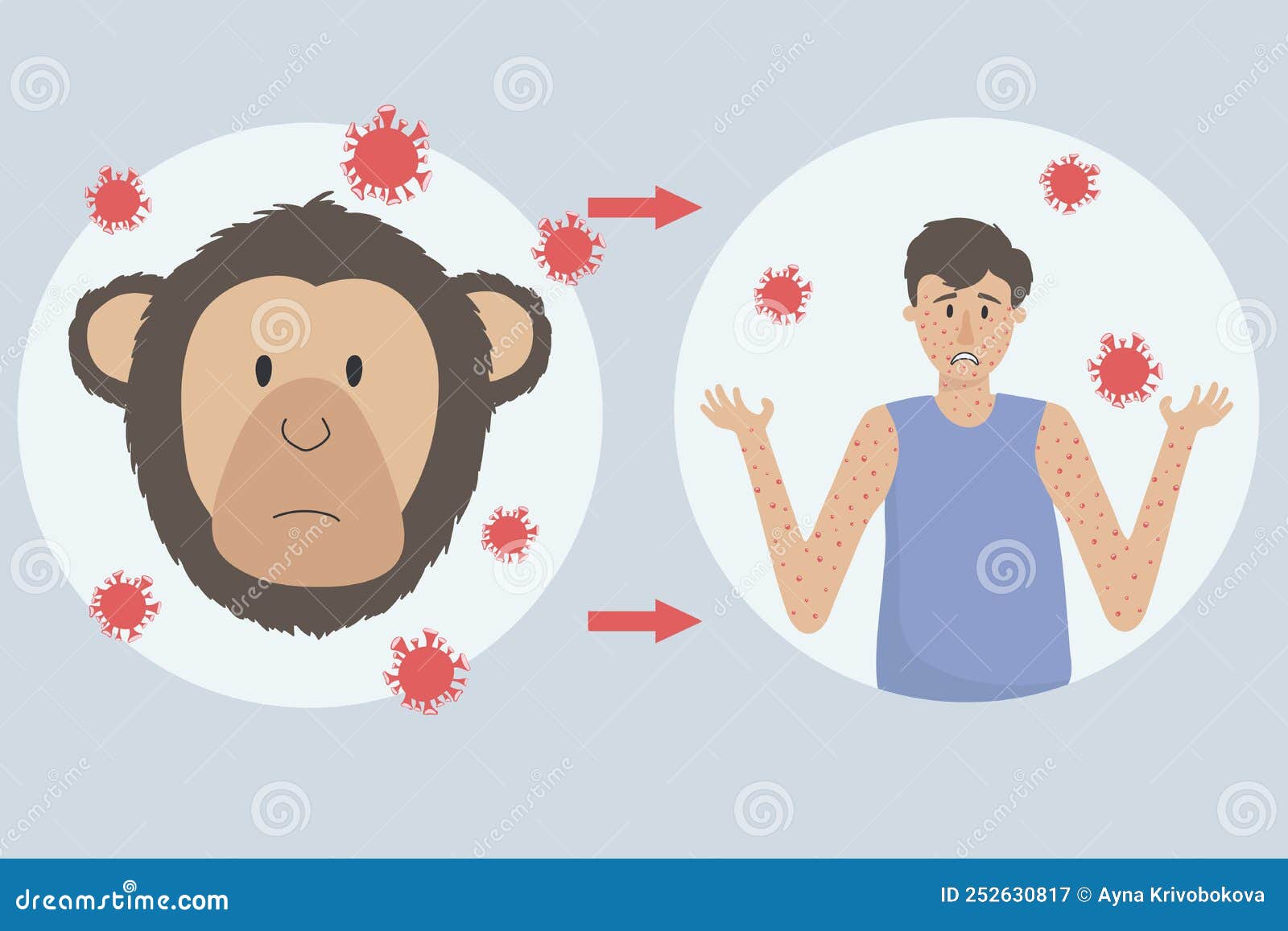 Monkeypox Virus Shows the Route of Infection from a Monkey and the ...