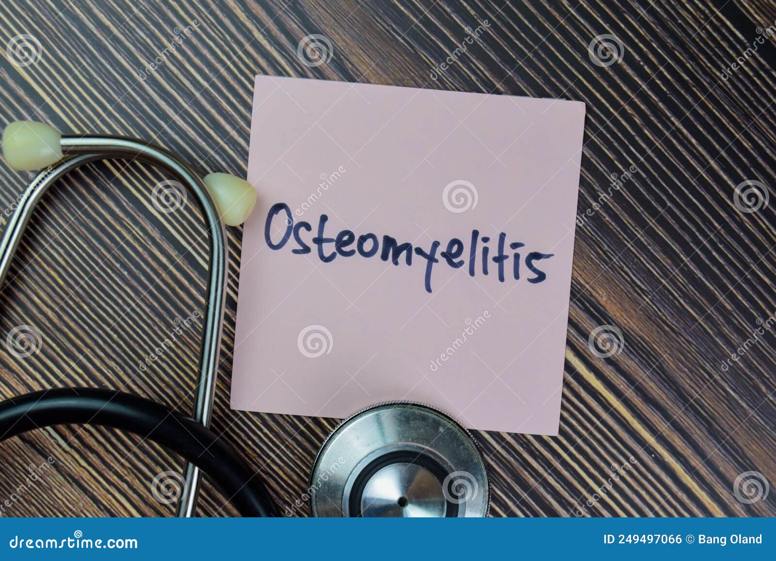 Osteomyelitis Is An Infection Of Bone. Staphylococcus Aureus Most ...