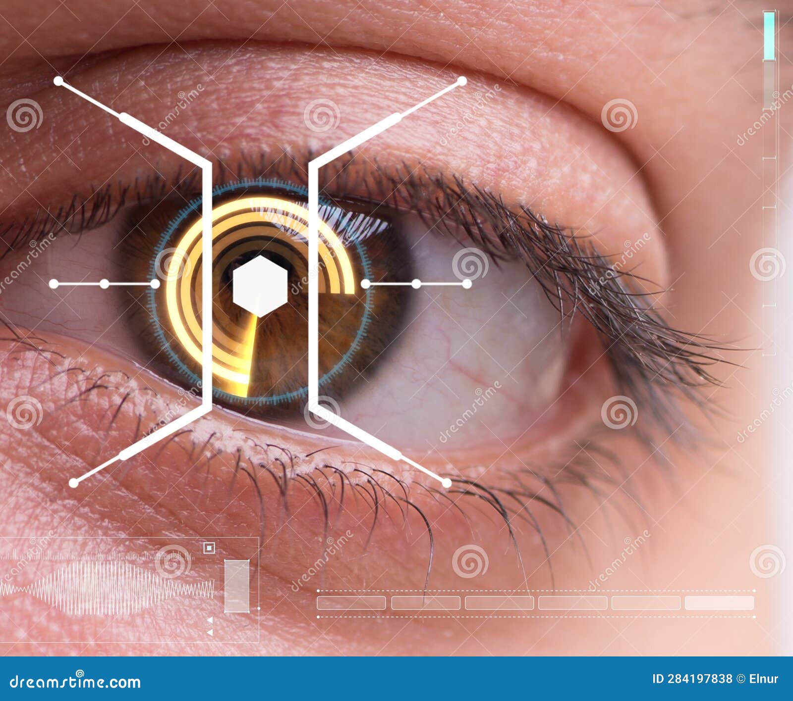Concept of Sensor Implanted into Human Eye Stock Photo - Image of ...