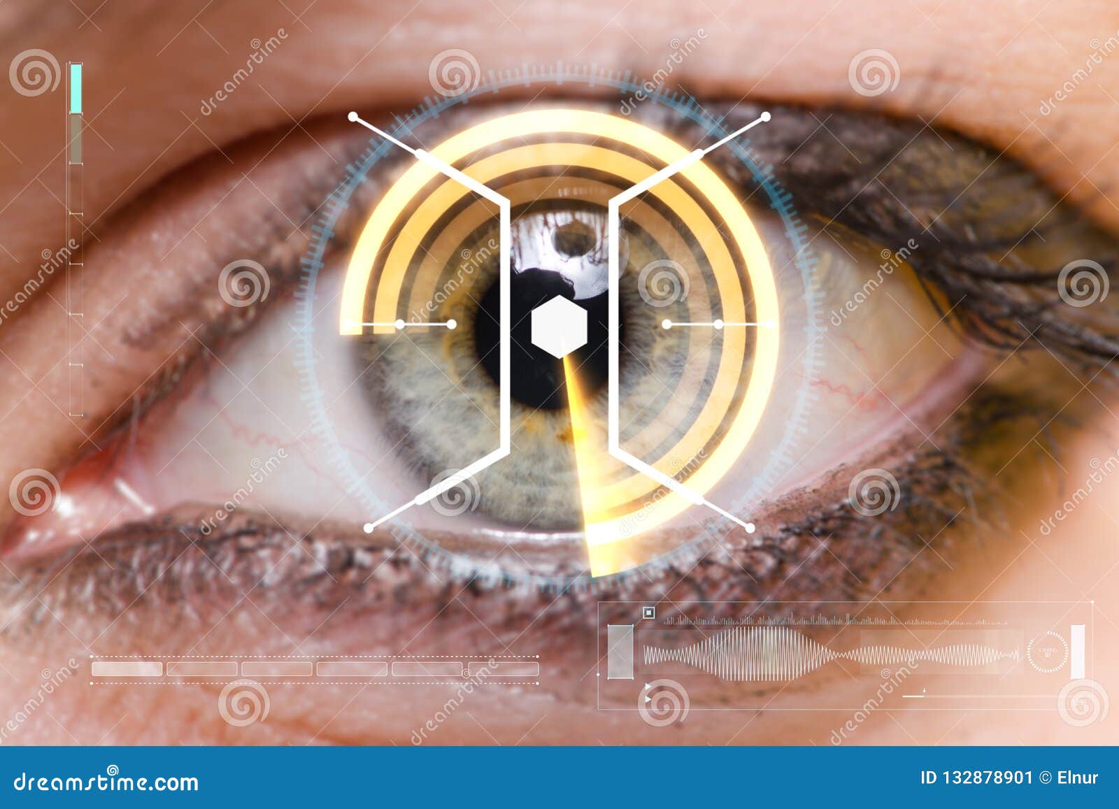 The Concept of Sensor Implanted into Human Eye Stock Image - Image of ...