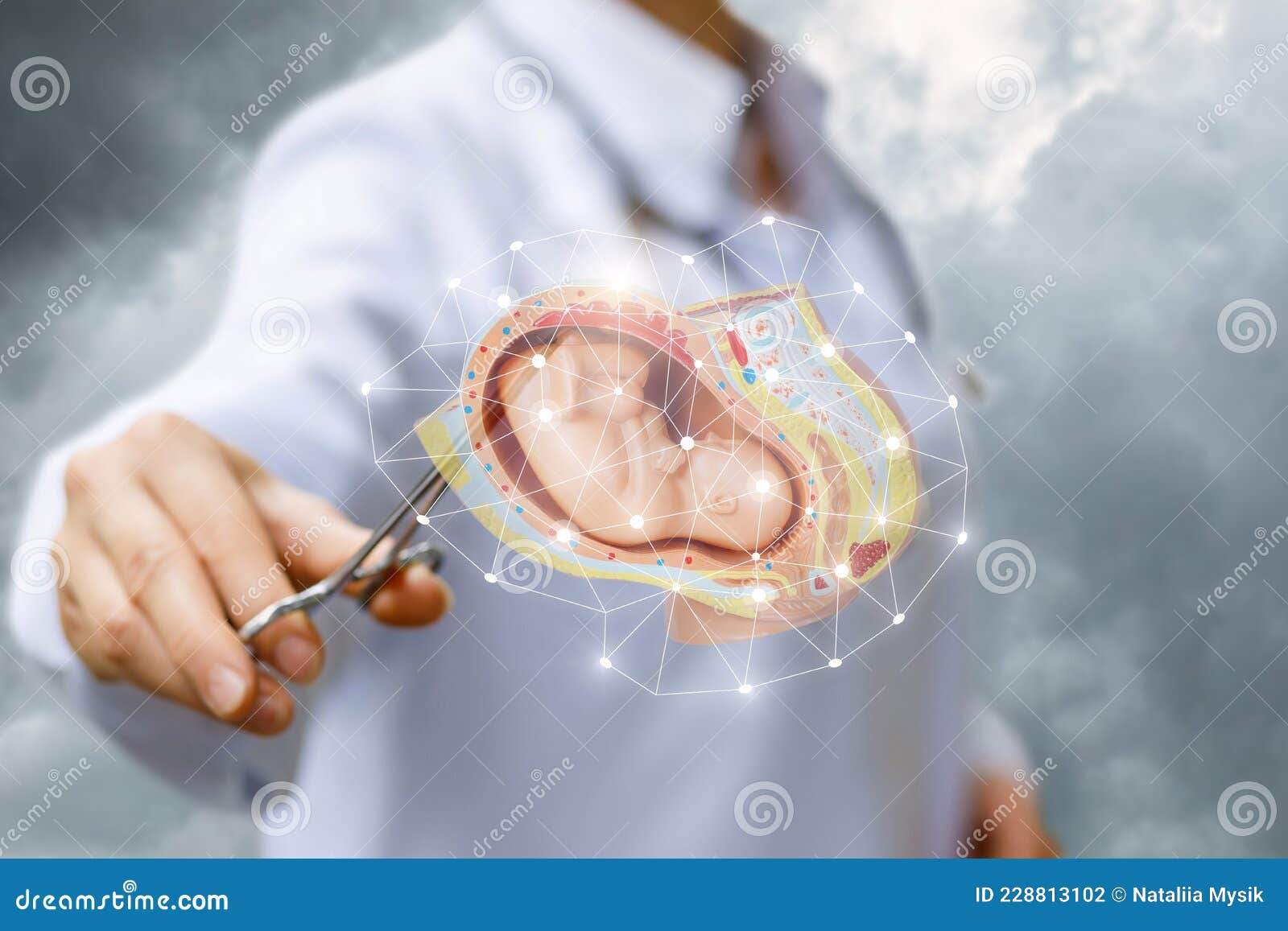 The Concept of Surgery during Pregnancy Stock Photo - Image of glowing ...
