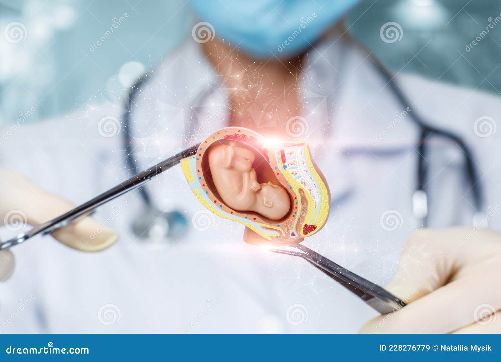 Surgical Intervention For Intestinal Obstruction And Resection Of ...