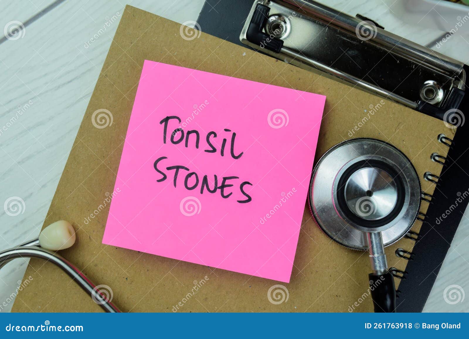 Tonsil Stone Tonsillolith Stock Photography | CartoonDealer.com #187679774