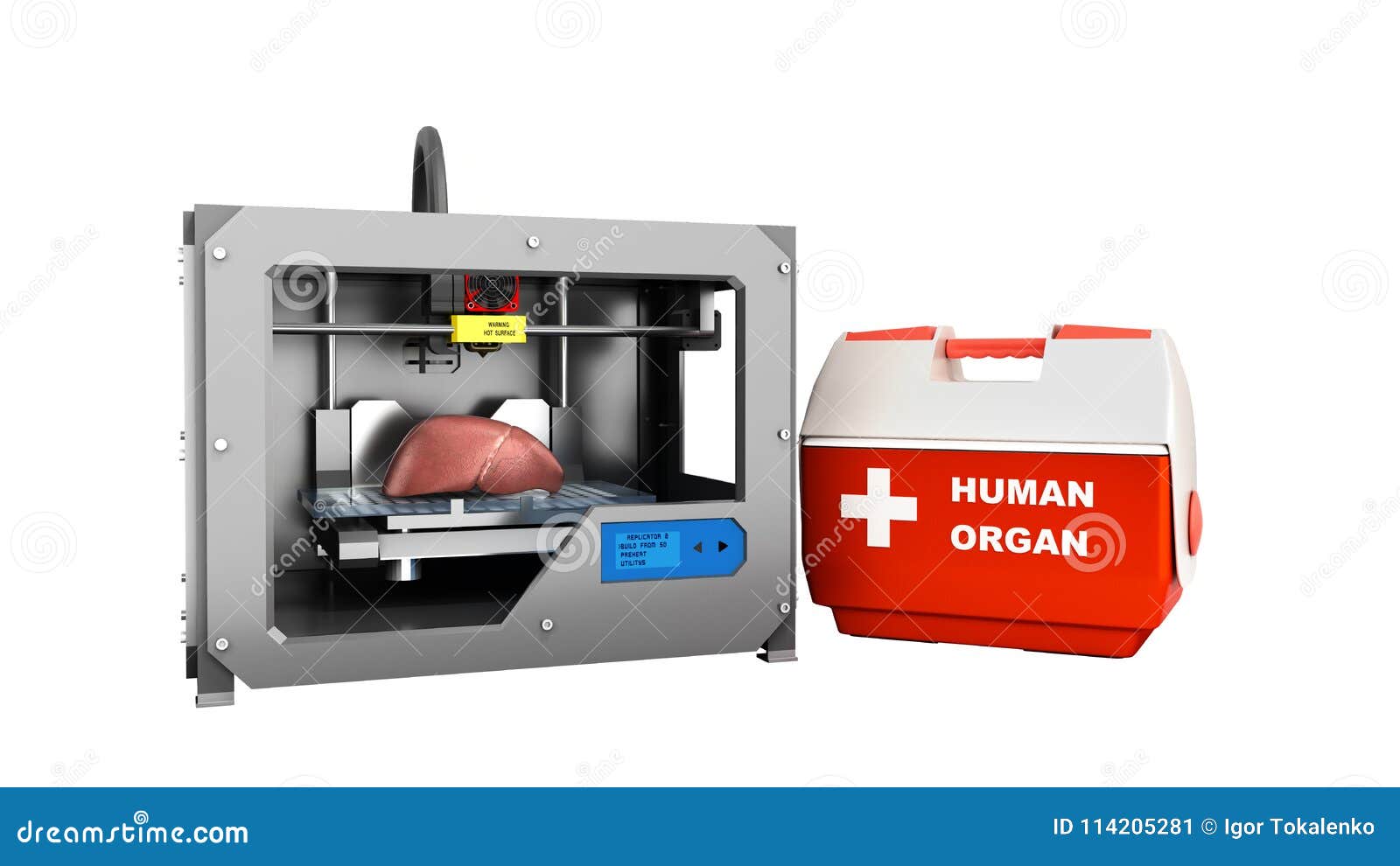 Concept of Transplantation Process of Creating Human Organs Using 3D ...