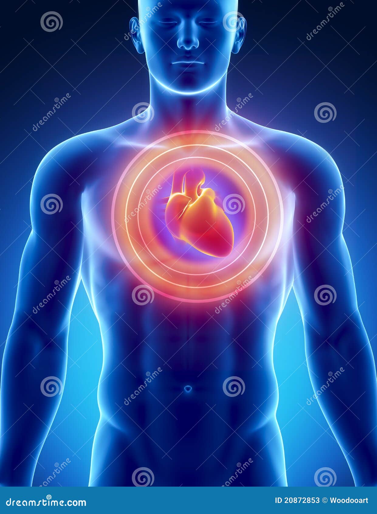 Concepto Del Ataque Del Corazón Stock de ilustración - Ilustración de ...