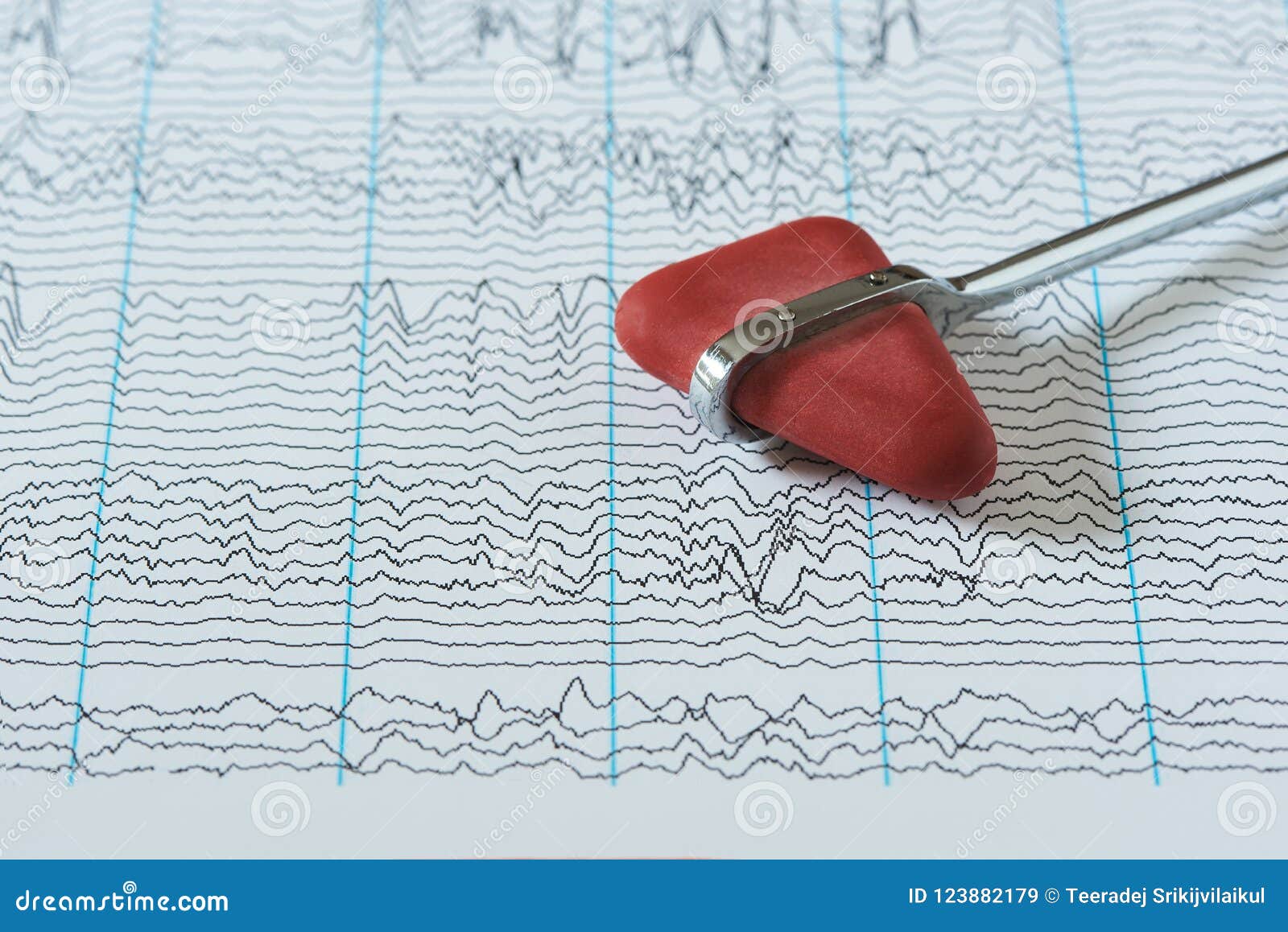 Concepts of Neurological Instrument on Brain Wave Background Stock ...