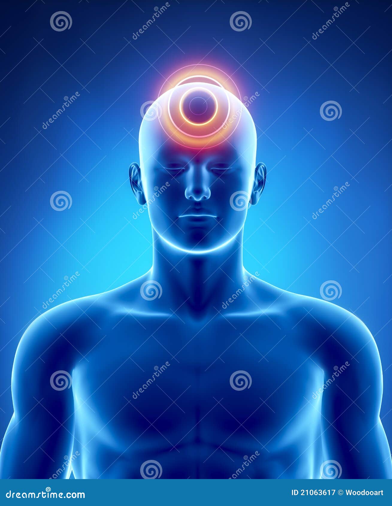 Concetto Di Emicrania E Di Emicrania Illustrazione di Stock ...