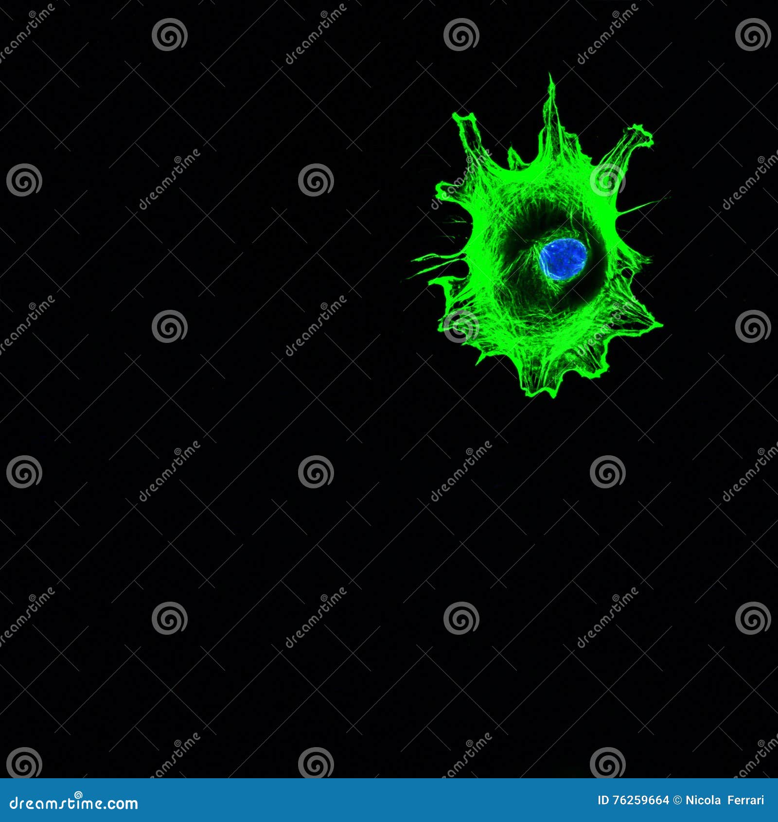 Confocal Microscopy Imaging of a Single Cancer Cell Invading Stock ...