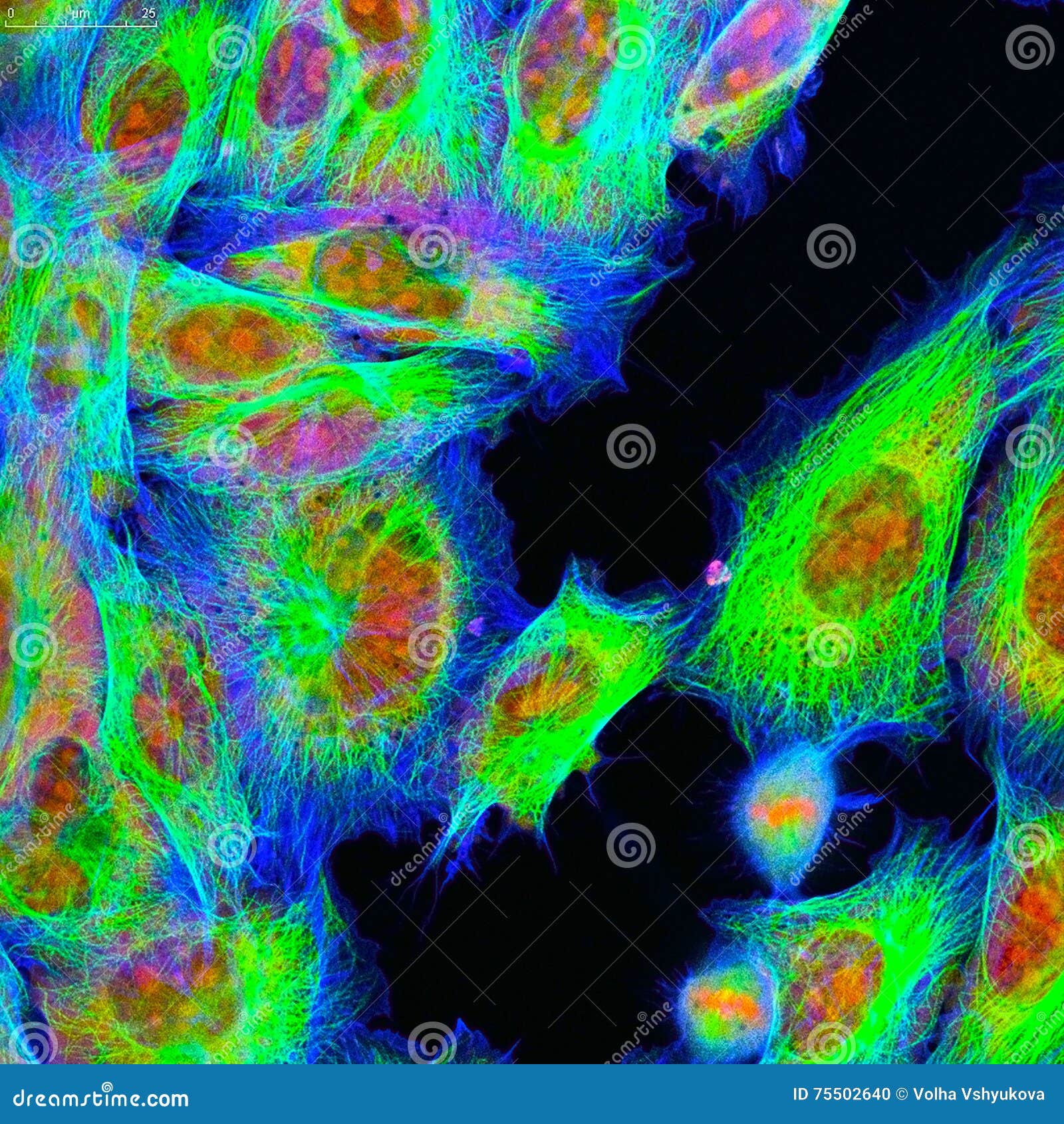Confocal Mikroskopi Av Fibroblastceller Arkivfoto - Bild av cell ...