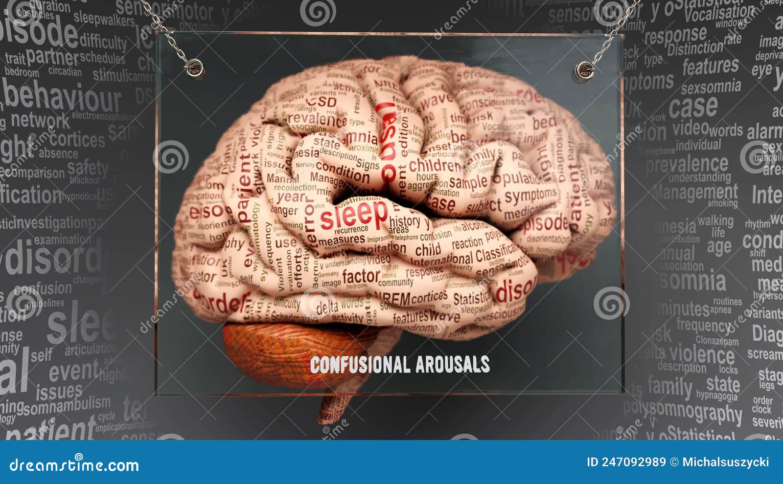 Confusional Arousals in Human Brain Stock Illustration - Illustration ...