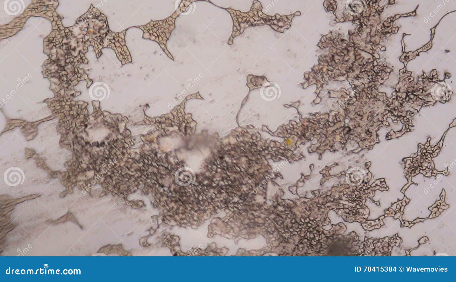 Congealed Blood Cells Under the Microscope Stock Footage - Video of ...