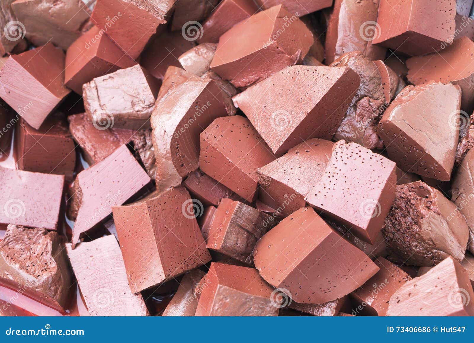 Congealed Blood Cells Under The Microscope Royalty-Free Stock ...