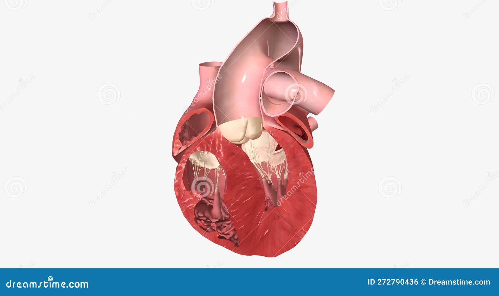 Congestive Heart Failure Left Sided Diastolic Stock Illustration ...