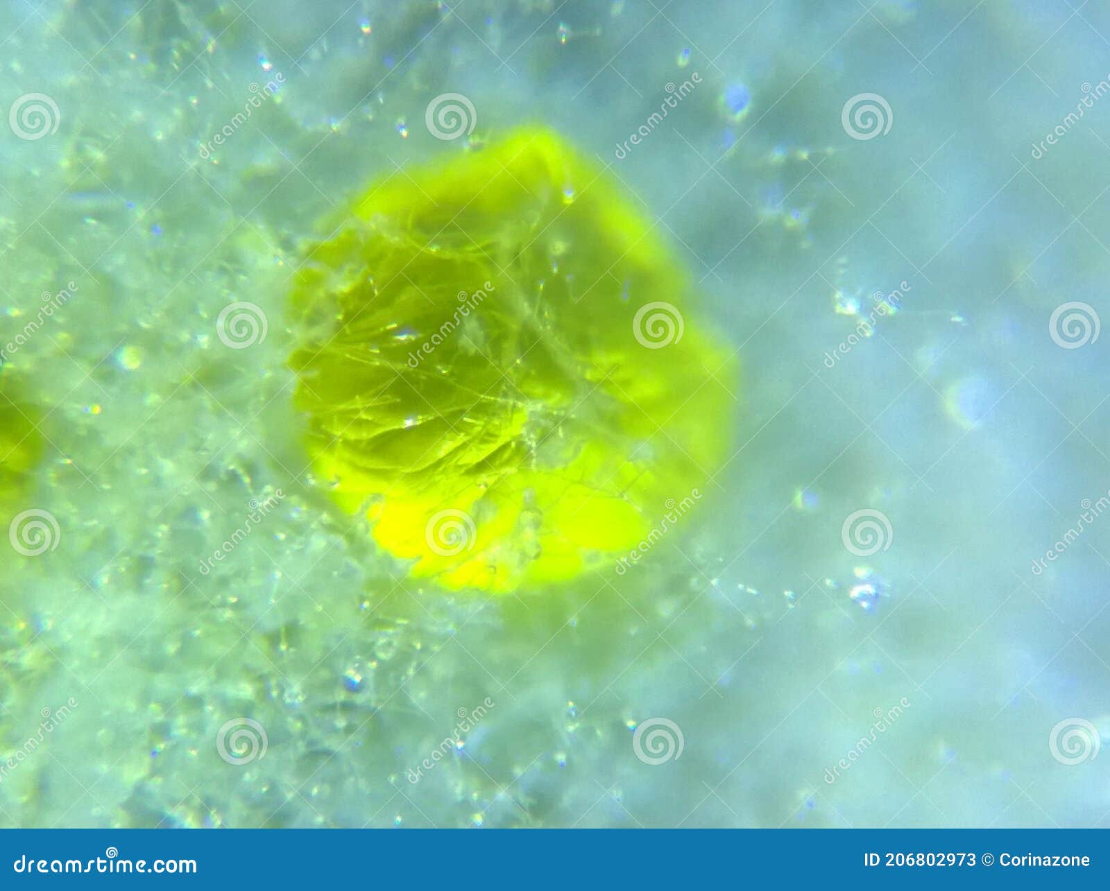 Aspergillus Flavus Mold Conidia Under the Microscope Stock Image ...
