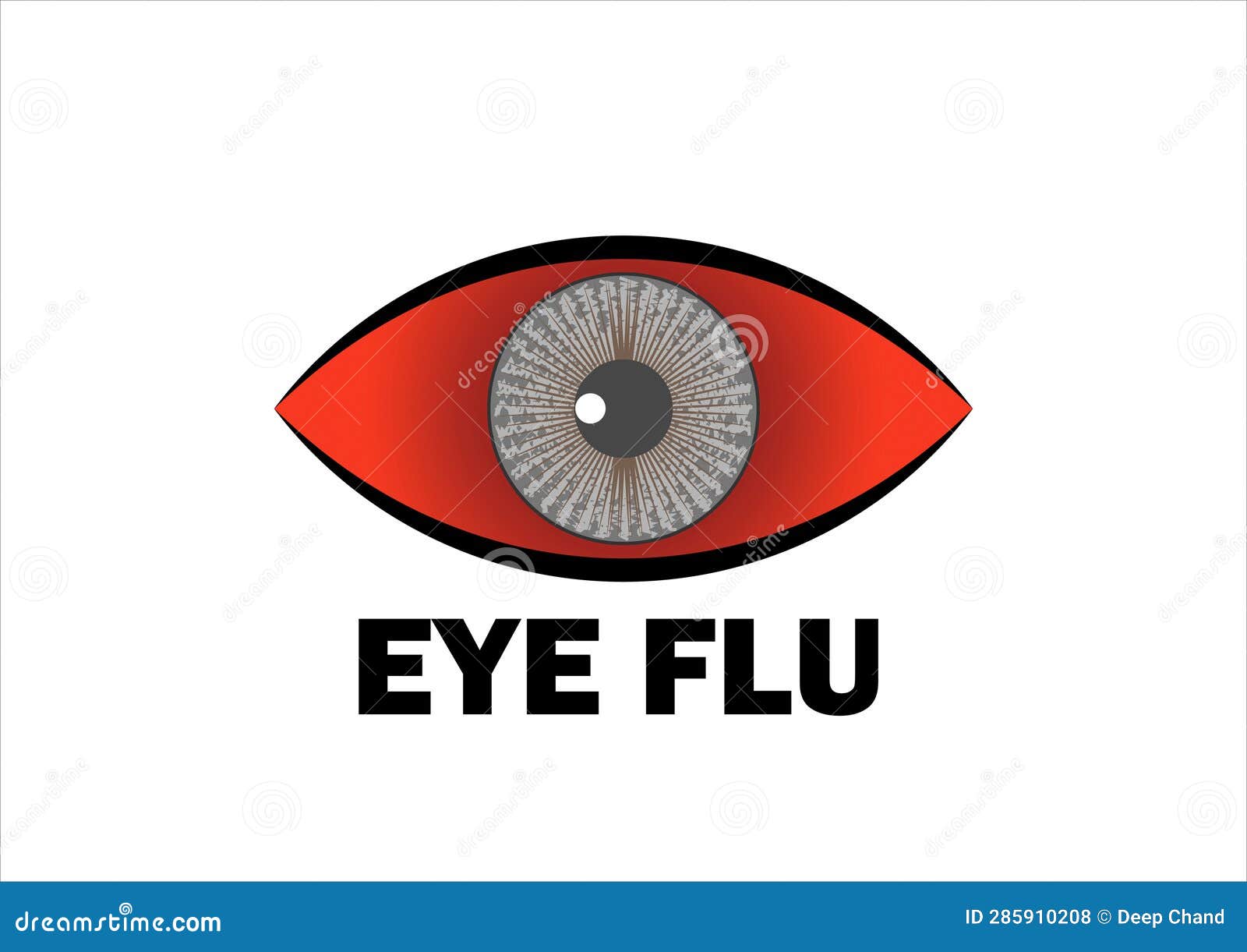 Conjunctivitis Virus Affected Red Eye,eye Flu Infection Vector ...