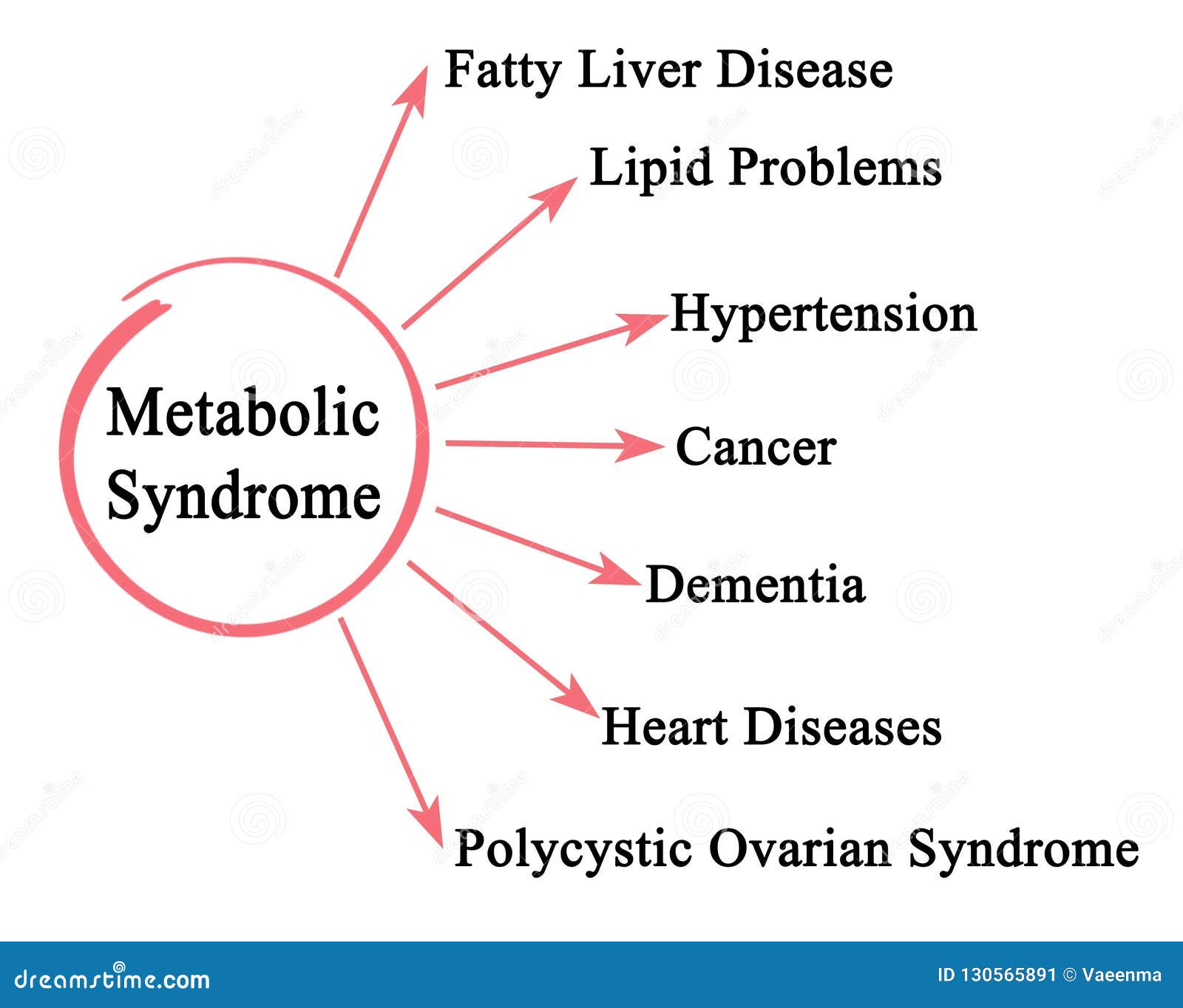 Consequences of Metabolic Syndrome Stock Illustration - Illustration of ...