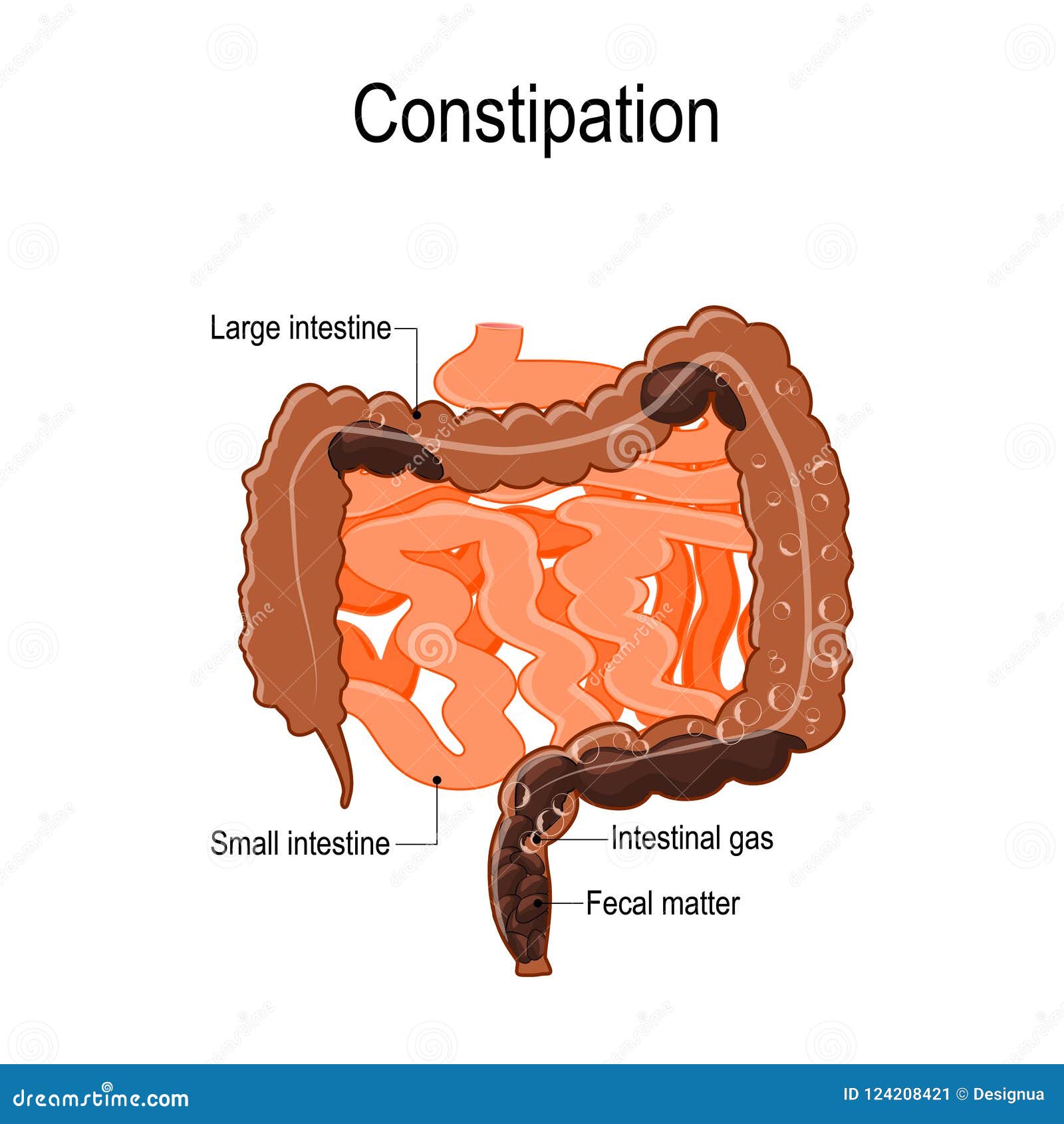 Constipation Ilustrações, Vetores E Clipart De Stock – (6,975 Stock ...