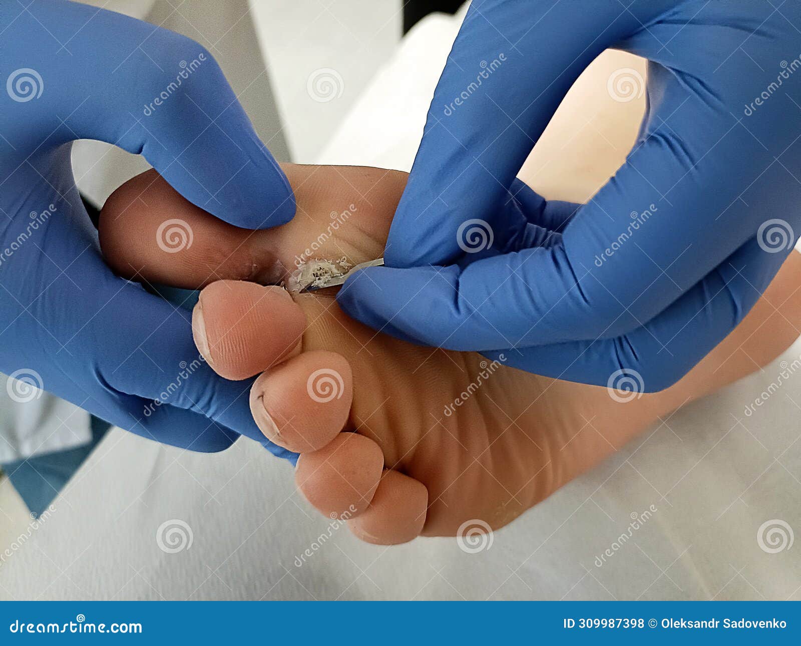 Consultation with a Dermatologist Stock Photo - Image of mittens ...