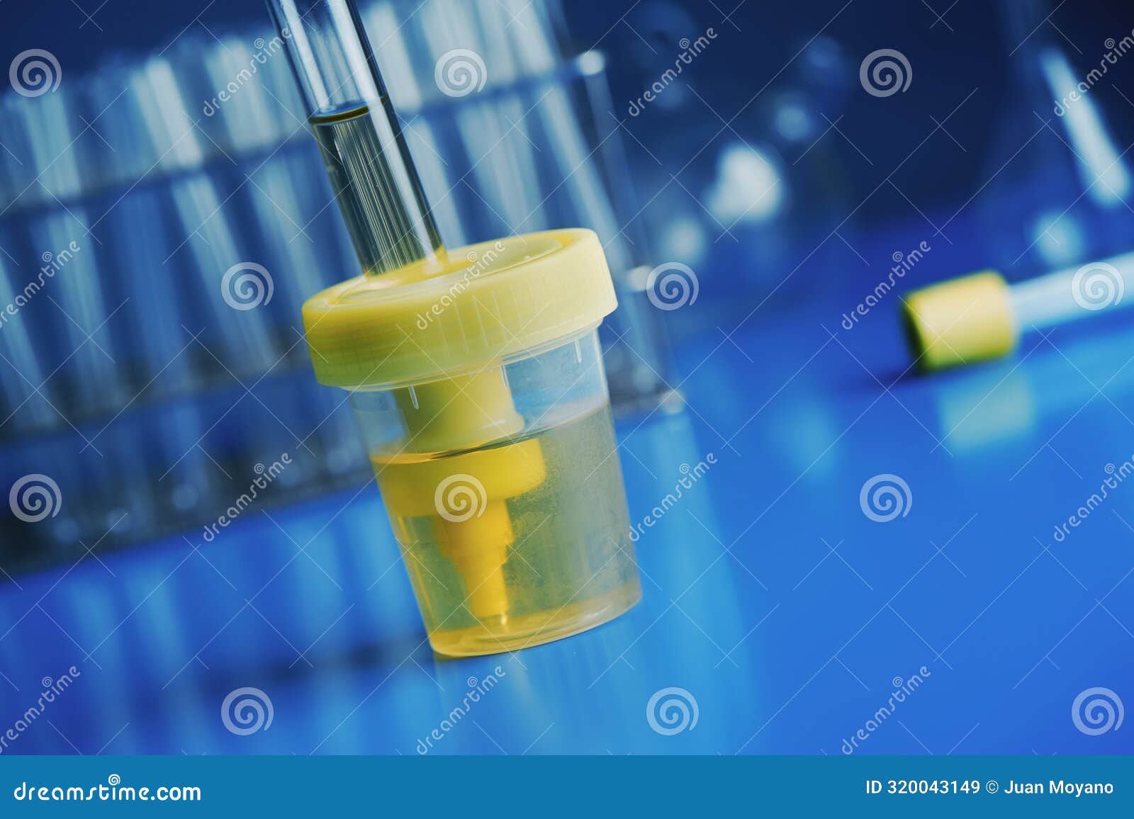 Container with a Sample of Urine in the Laboratory Stock Image - Image ...