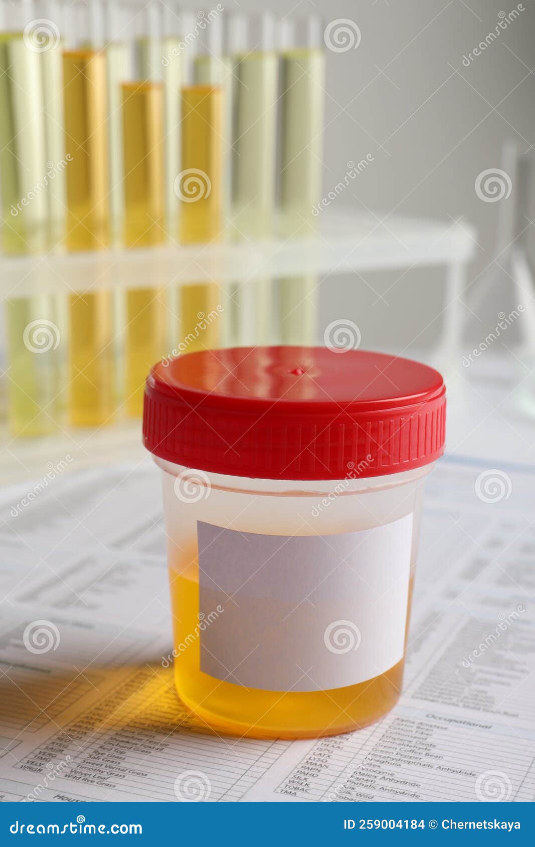 Container with Urine Sample for Analysis on Table Stock Photo - Image ...
