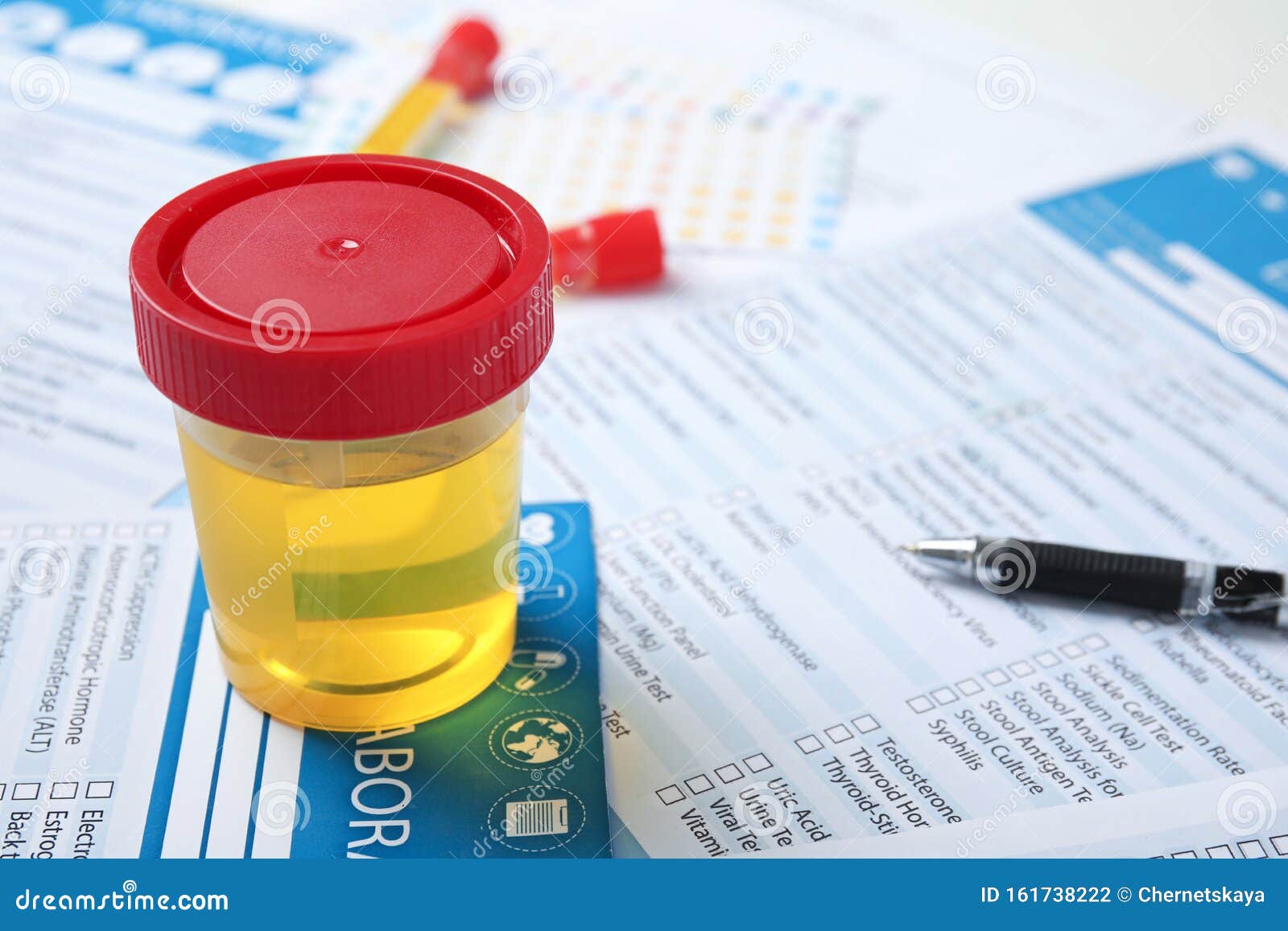 Container with Urine Sample for Analysis Stock Photo - Image of ...