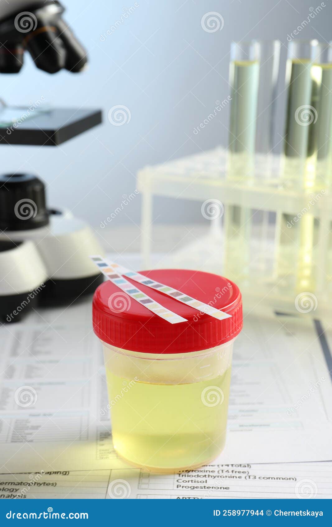 Container with Urine Sample for Analysis on Test Forms in Laboratory ...