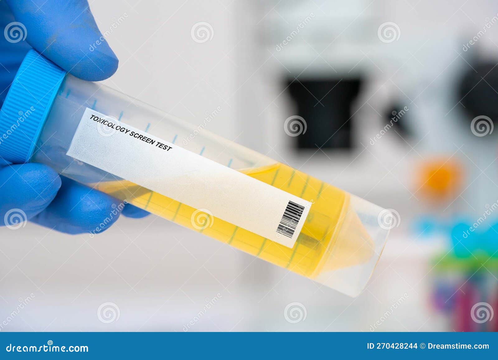 Container with a Urine Sample for Microbiological Laboratory Analysis ...