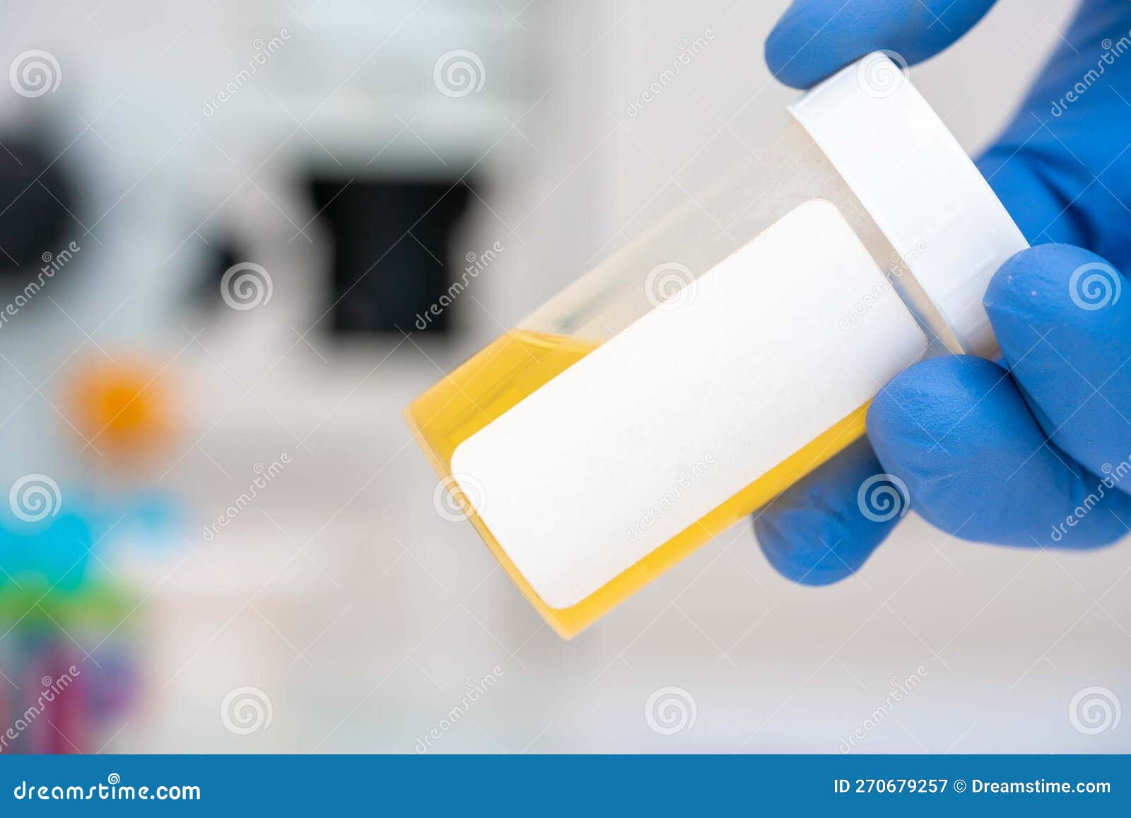 Container with a Urine Sample for Microbiological Laboratory Analysis ...