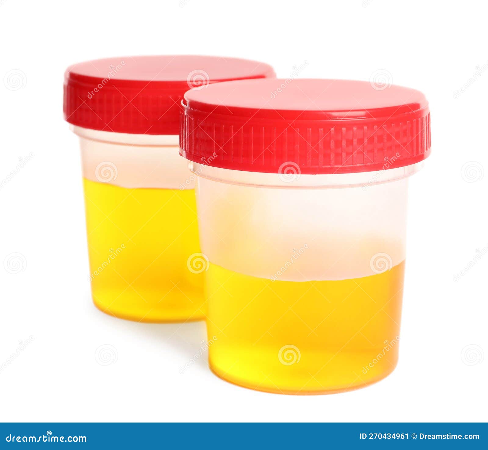 Containers with Urine Sample for Analysis on White Background Stock ...