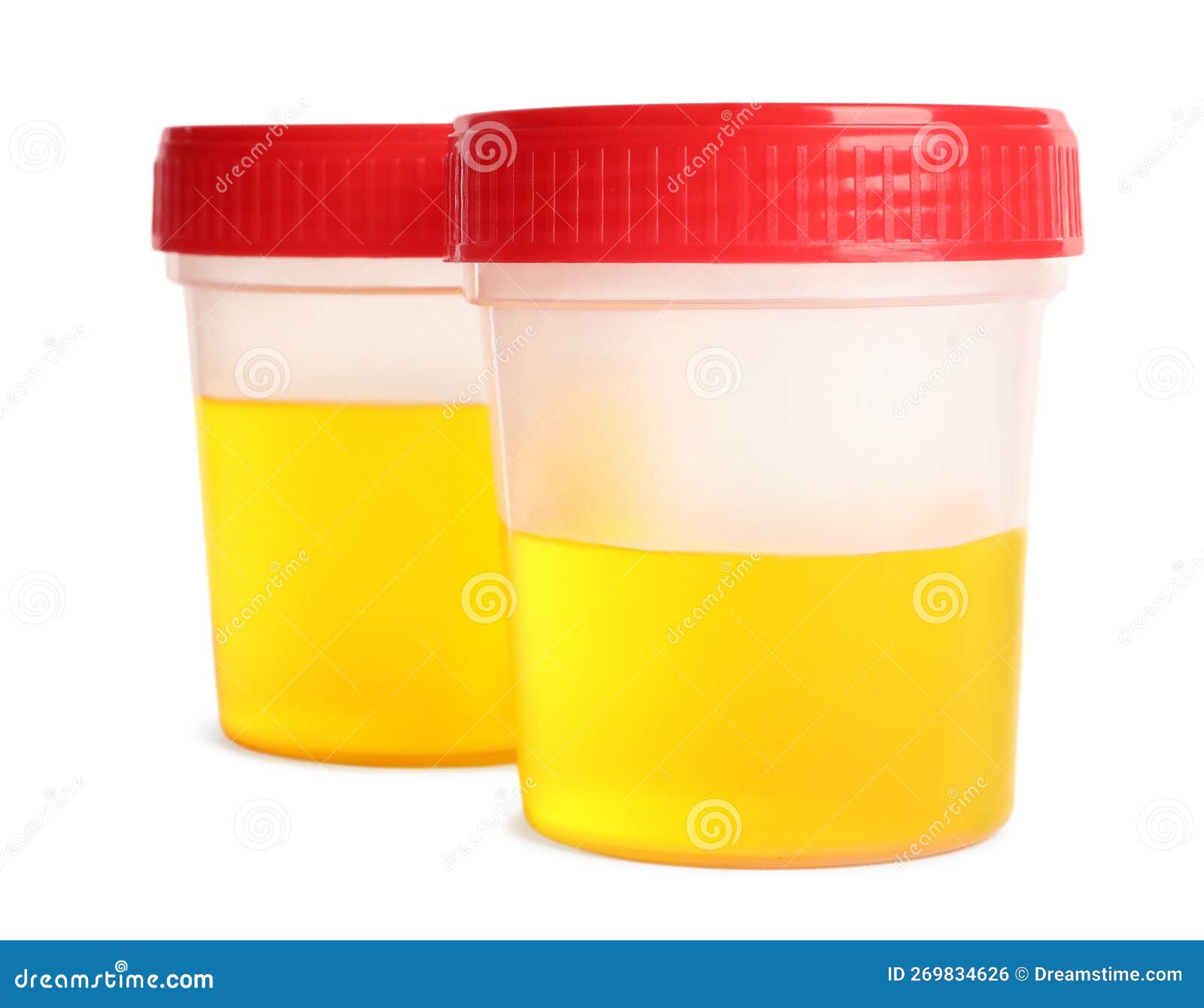 Containers with Urine Sample for Analysis on White Background Stock ...