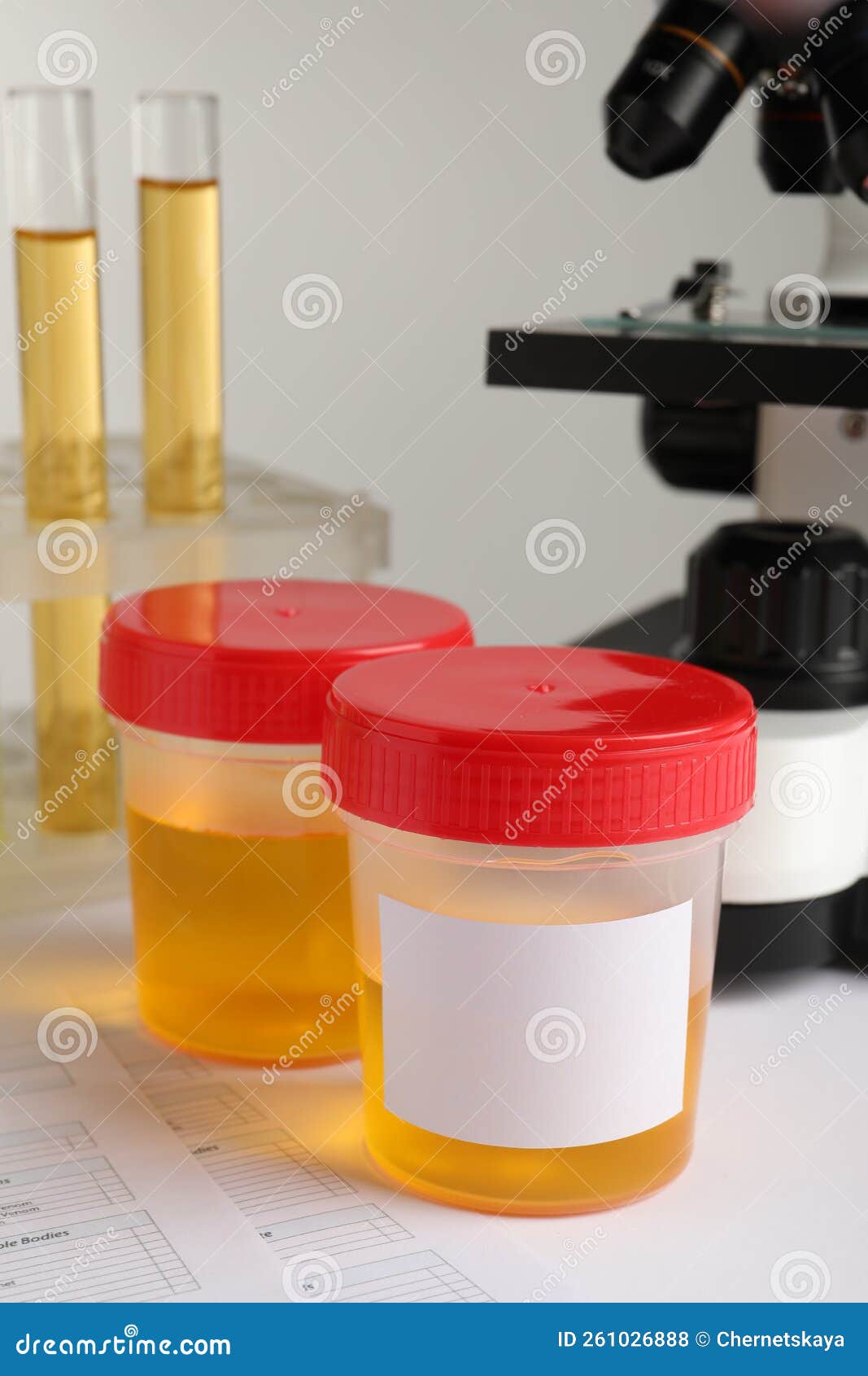 Containers with Urine Samples for Analysis on Table in Laboratory Stock ...