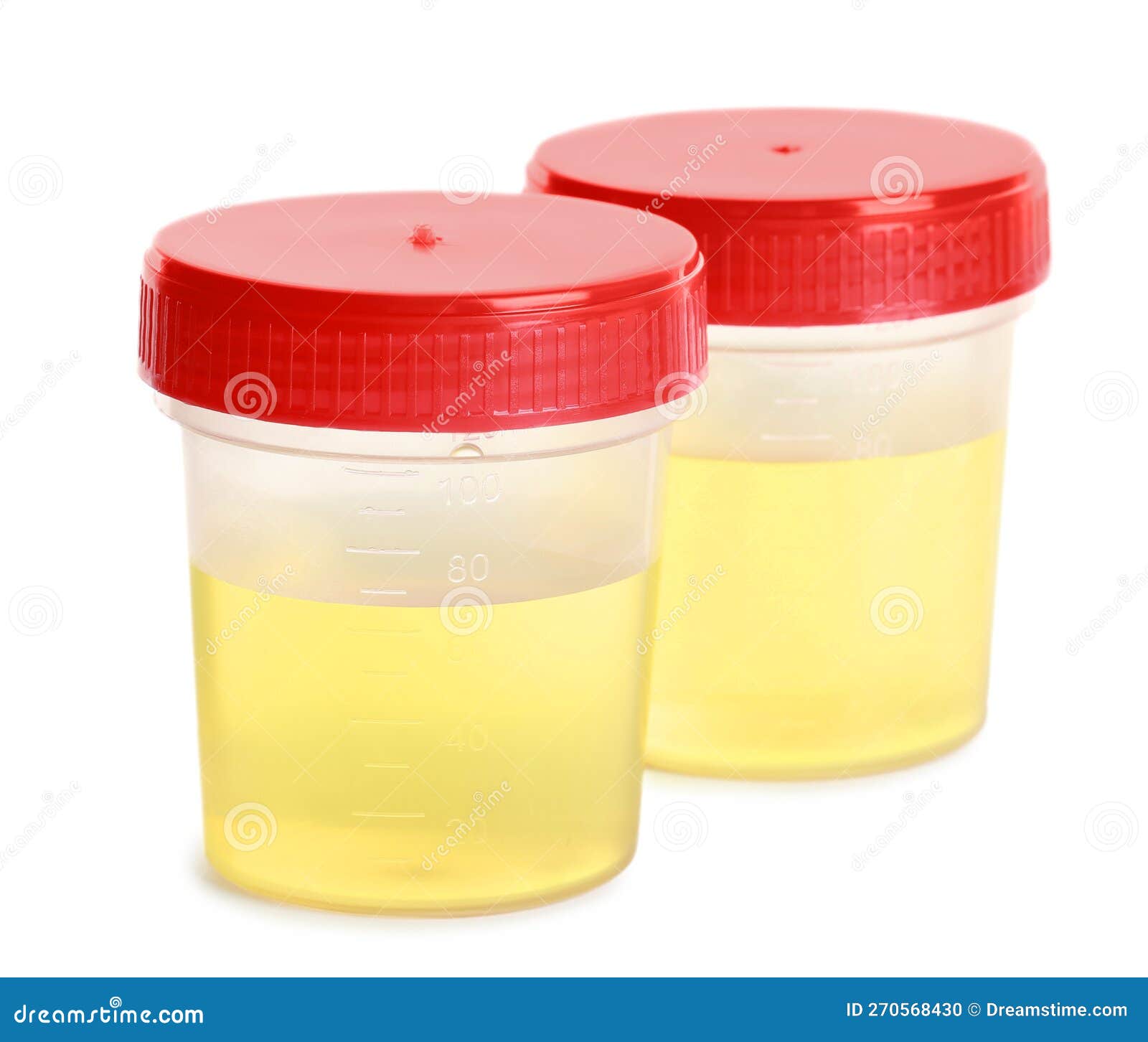 Containers with Urine Samples for Analysis on White Background Stock ...