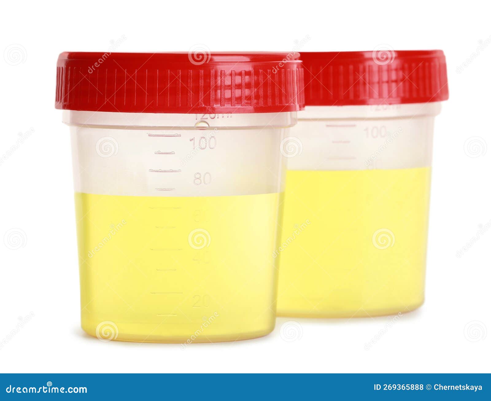 Containers With Urine Samples On Table In Laboratory Royalty-Free Stock ...