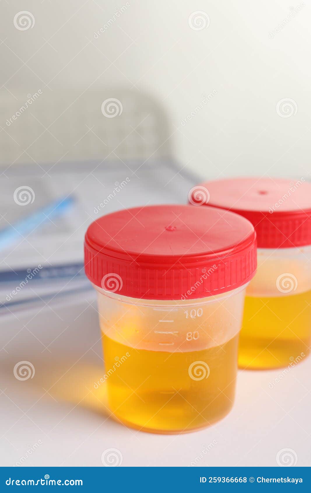 Containers With Urine Sample For Analysis, Litmus Paper And Medical ...