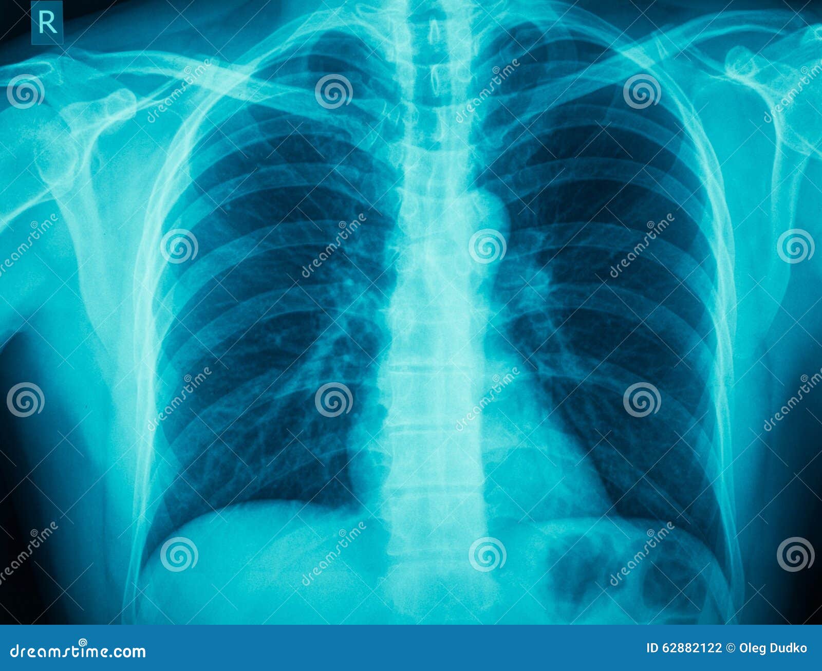 Copd stock photo. Image of sickness, examination, abdominal - 62882122
