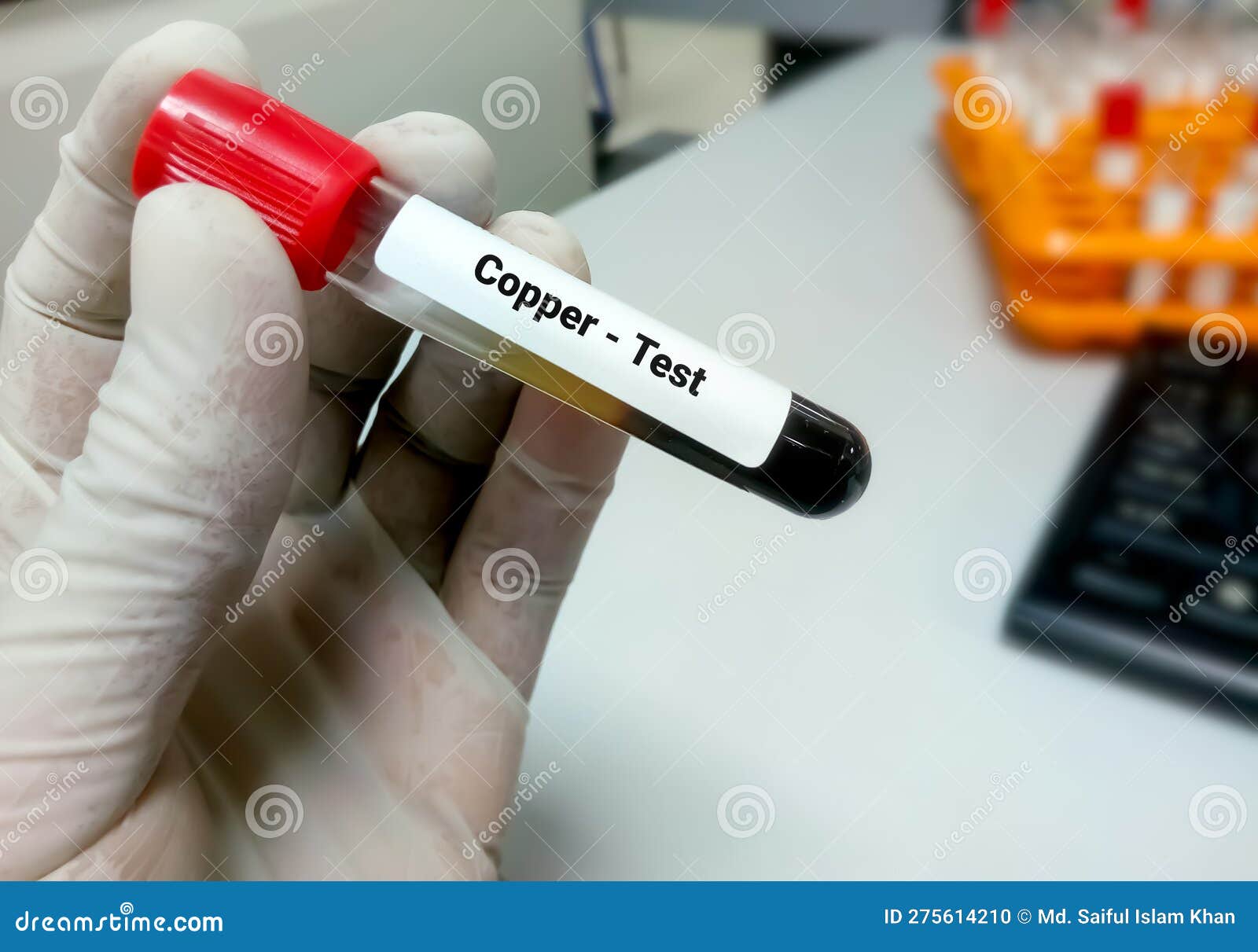 Copper (cu) Test. Blood Toxicity Testing Stock Photo - Image of ...