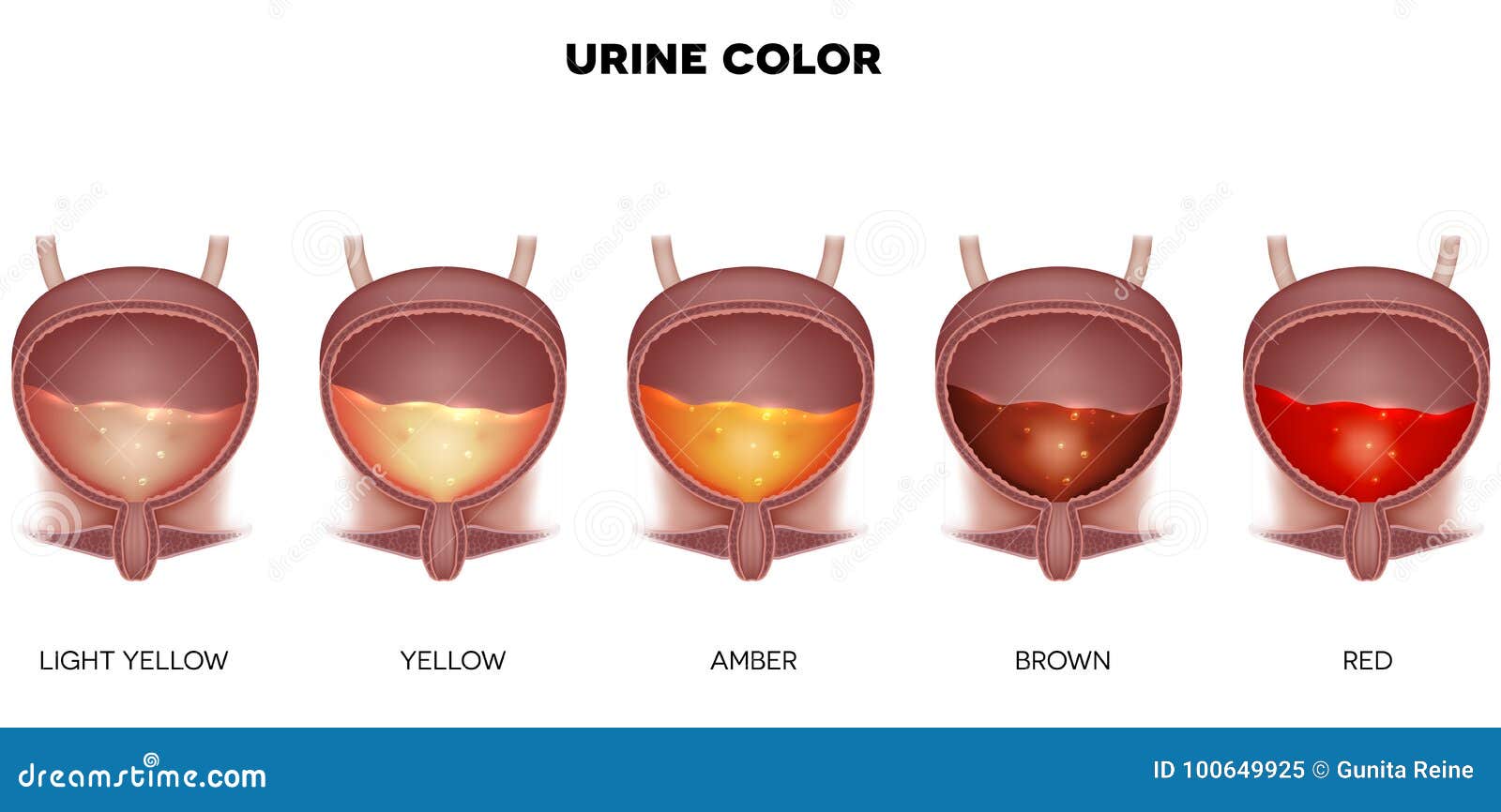 Cor da urina ilustração do vetor. Ilustração de humano - 100649925