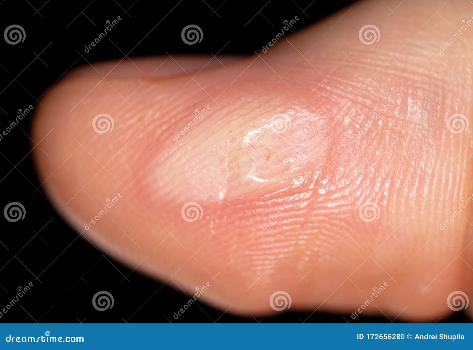 Corn on a Finger Isolated on a Black Stock Photo - Image of hand, care ...