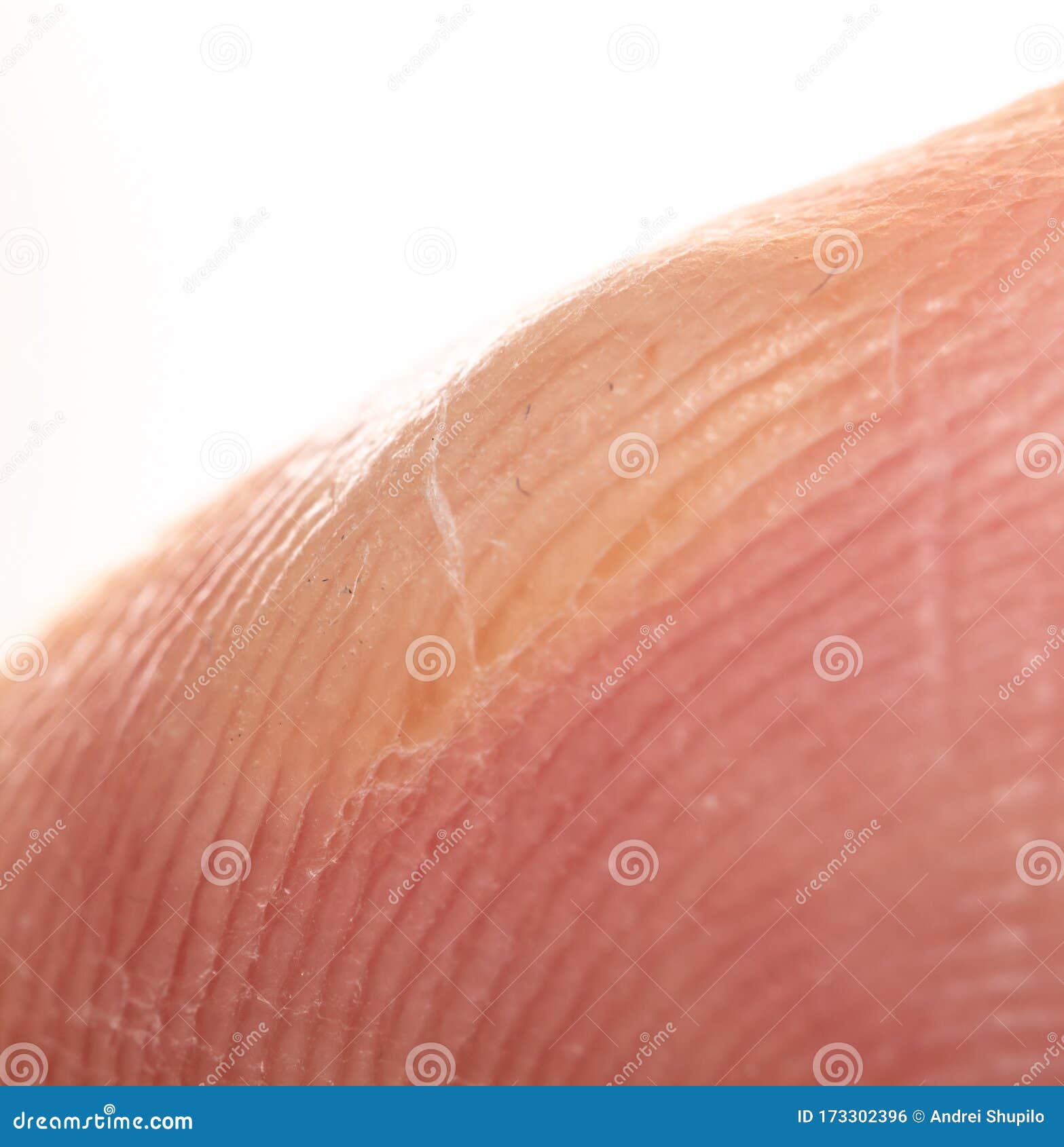 Corn on a Finger Isolated on a White B Stock Photo - Image of closeup ...