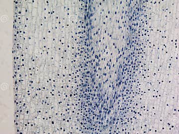Corn root tip micrograph stock photo. Image of cell, micrograph - 47875944