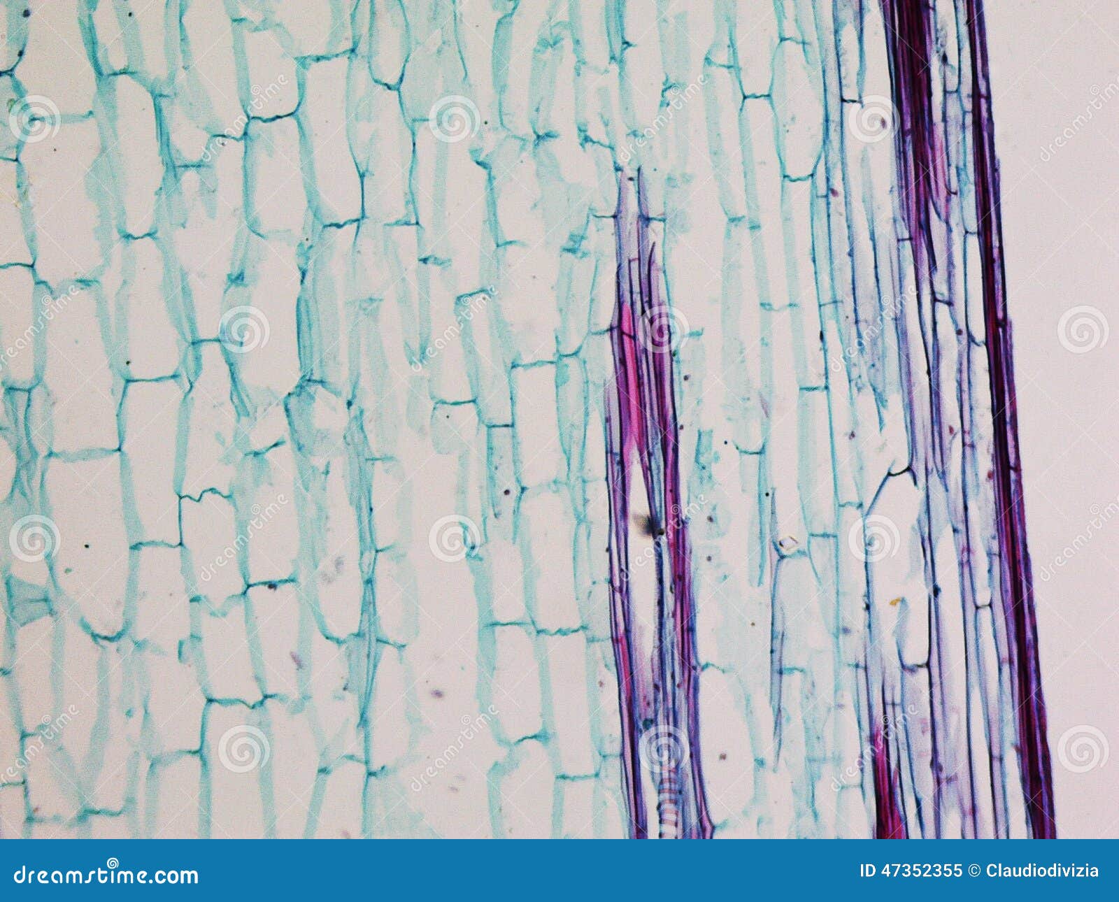 Longitudinal Section Of A Stem