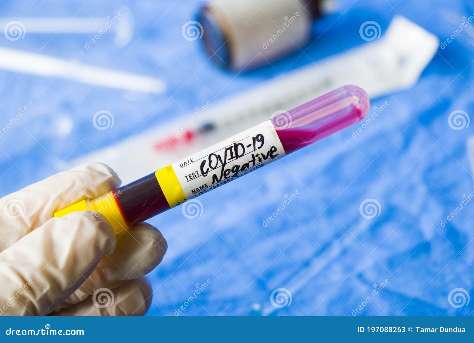 Corona Virus Negative Test Samples. Diagnosis and Laboratory. Studio ...