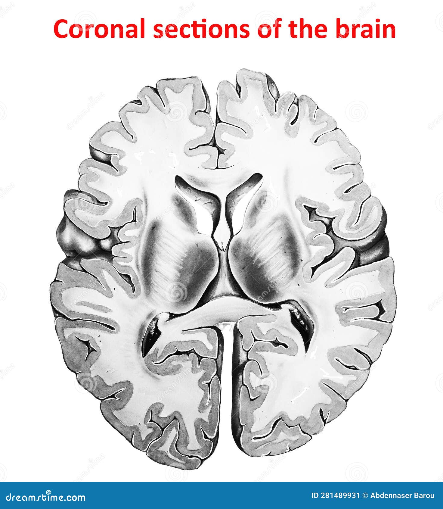 Coronal Section Of Brain Drawing