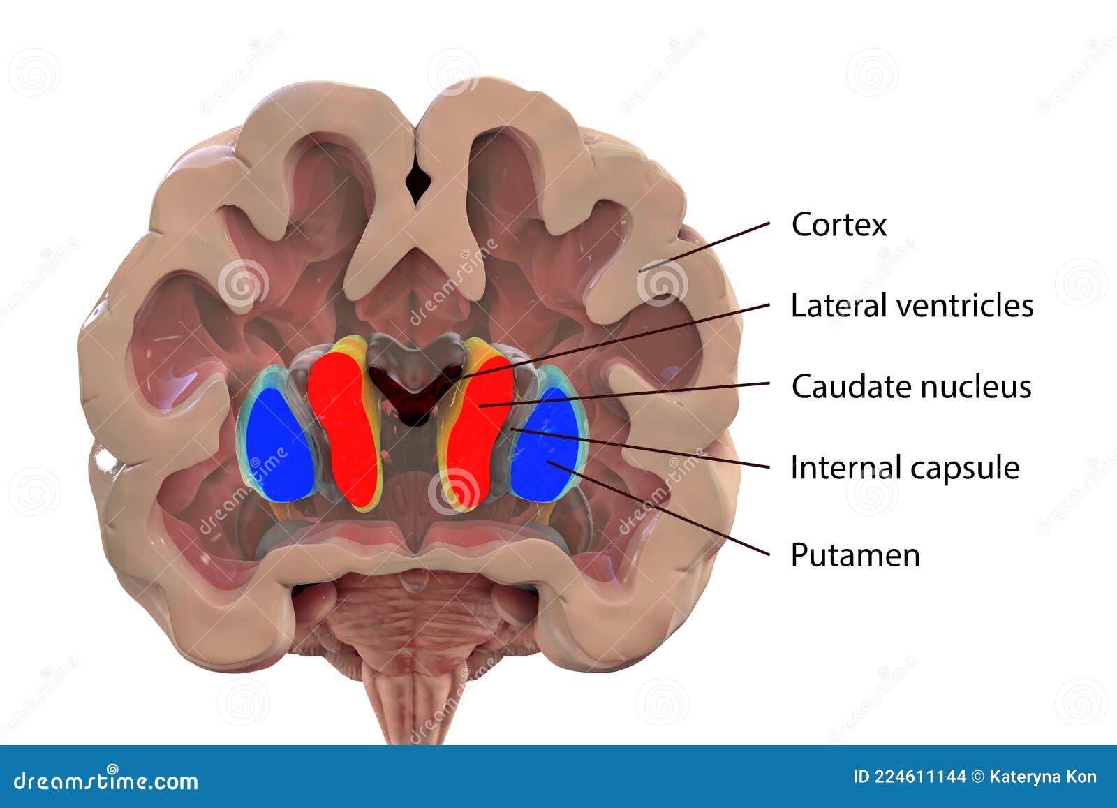 Coronal Section of a Healthy Brain Showing Normal Anatomy of Basal ... Coronal Section of a Healthy Brain Showing Normal Anatomy of Basal ...